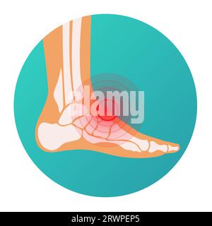 Human foot with bones and joints as in xray, medical chart vector ...