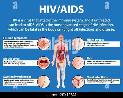 Illustration depicting how HIV/AIDS virus attacks immune system and ...