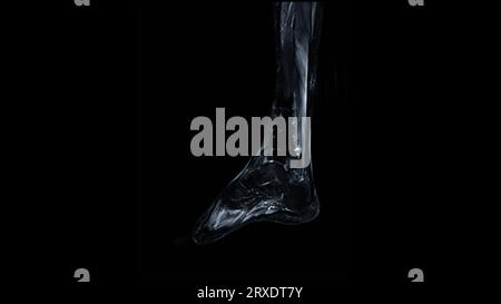 MRI FOOT scan Sagittal view T2 Fat suppression technique for diagnostic ...