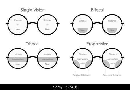 Set of Zones of vision in progressive lenses Fields of view Eye frame ...