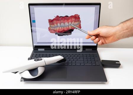 3D Picture of Scanned Teeth on Monitor of Computer, Notebook. White 3d ...