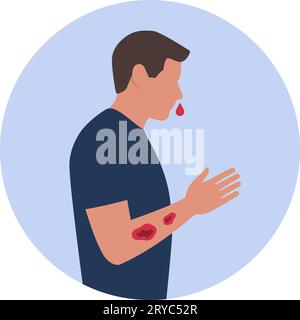 Easy bleeding, bruising and injury icon: man with nosebleed and bruises ...