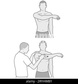 The external rotation test is a clinical examination technique used by ...