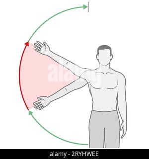 The Painful Arc Test is a clinical examination for shoulder impingement ...
