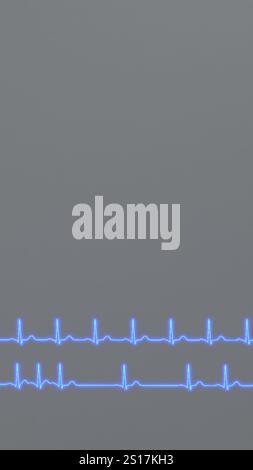 ECG graphs comparison of normal heart rhythm and arrhythmia Stock Photo ...