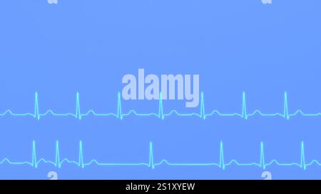 ECG graphs comparison of normal heart rhythm and arrhythmia Stock Photo ...