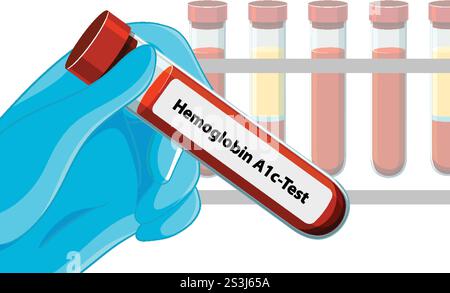 Diabetes. A1C test. Glucose monitoring, glycemic index. Hyperglycemia ...