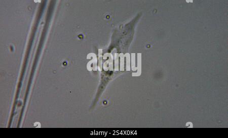 Lobose amoebae (Lobosa Stock Photo - Alamy