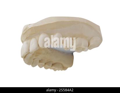 teeth mold isolated on white background. teeth mold isolated on white ...