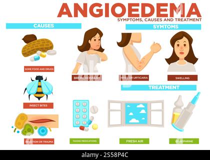 vector illustration of angioedema. allergic swelling of the soft ...