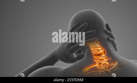 Cervical Syndrome Leading to Chronic Neck Discomfort Stock Photo - Alamy