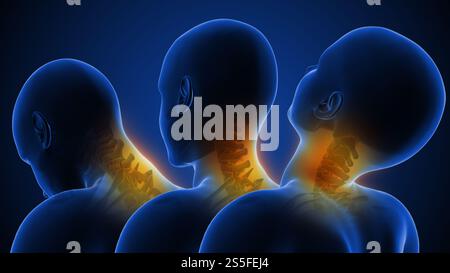 Chronic Neck Pain Caused by Poor Posture Stock Photo - Alamy