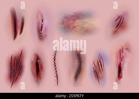 Bloody wounds. Scars, surgical stitches and bruis, skin cuts. Bloody ...