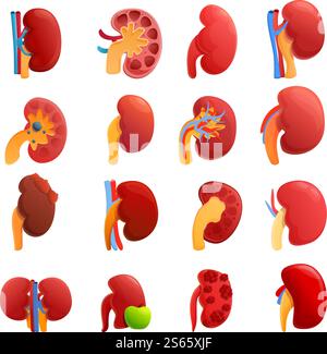 Polycystic kidney disease. Normal human kidney and polycystic kidney ...