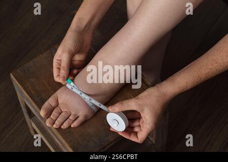 Woman measuring foot affected by lymphedema condition with tape measure ...