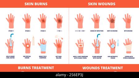 Burns degree. First aid for burn wound. Fire damage to skin ...