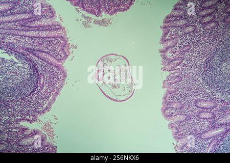 Oxiuris, pinworm in the intestine, microscopy 100x Stock Photo - Alamy