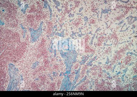 Lymph node tissue under the microscope 100x Stock Photo - Alamy