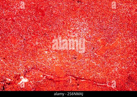 Spleen tissue under the microscope 100x Stock Photo - Alamy