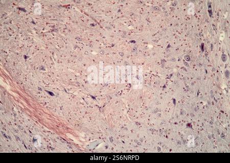 Brain cells tissue under the microscope 100x Stock Photo - Alamy