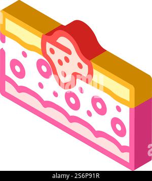 psoriasis skin disease isometric icon vector illustration Stock Vector ...