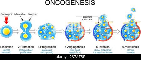 Cancer development. Carcinogenesis or Oncogenesis. Tumor cell ...