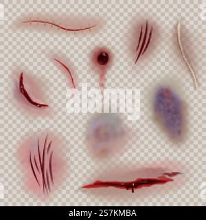 Realistic various surgical stitches, bloody wounds, scars, bruise and ...