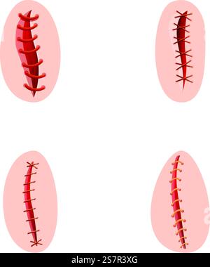 Suture icons set cartoon vector. Wound surgical Stock Vector Image ...