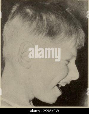 Happy Puppet Syndrome 4 Stock Photo - Alamy