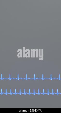 Comparison of ECG of normal heart rhythm and tachycardia Stock Photo ...