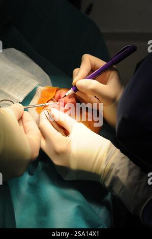 Cleft palate or harelip is a congenital malformation that will be ...