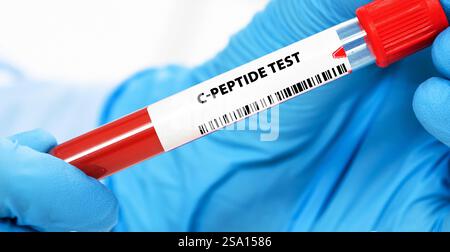 C-Peptide test. Measures C-peptide to assess insulin production and ...