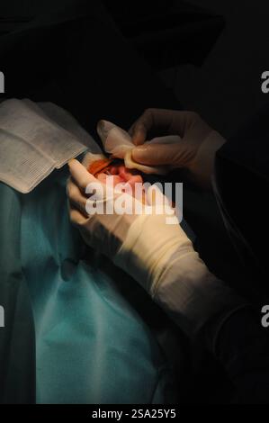 Cleft palate or harelip is a congenital malformation that will be ...