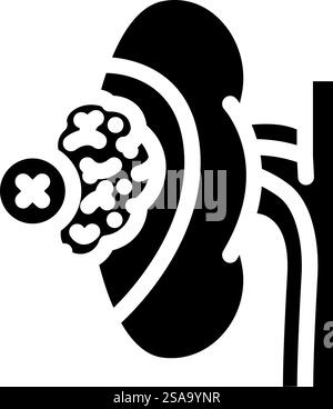 nephrectomy surgery hospital glyph icon vector illustration Stock ...
