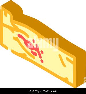 lymph node dissection surgery color icon vector. lymph node dissection ...