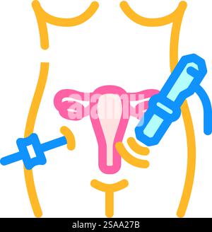 gynecologic laparoscopy surgery color icon vector illustration Stock ...