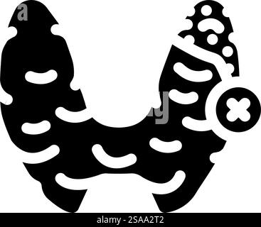 Thyroidectomy vector illustration Stock Vector Image & Art - Alamy