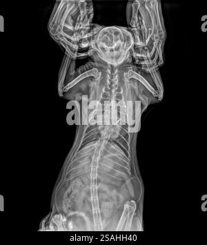 Chest x-ray image for screening diagnosis TB,tuberculosis and covid-19 ...