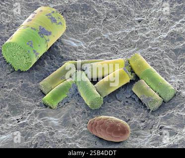 Amoeba. Coloured scanning electron micrograph (SEM) of an Amoeba ...
