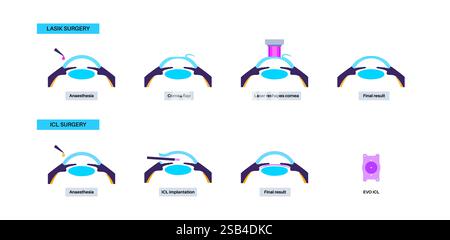 LASIK and EVO ICL eye surgery, illustration Stock Photo - Alamy