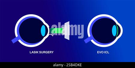 LASIK and EVO ICL eye surgery, illustration Stock Photo - Alamy