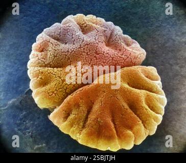 Desmid. Scanning electron micrograph (SEM) of three desmid green algae ...