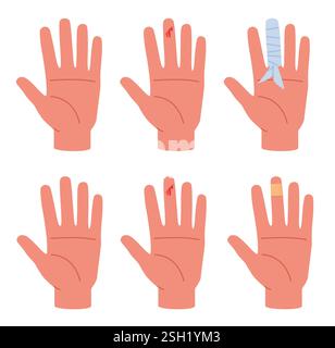 First aid for treating cut wound on hand. Treatment stages process for ...