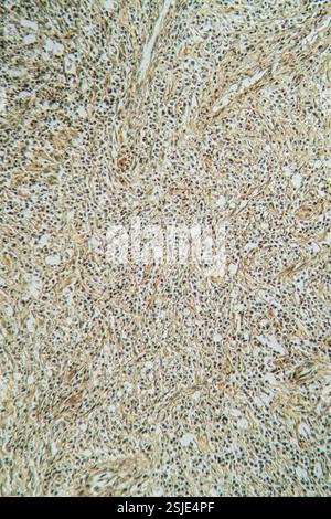 Bacterial disease under the microscope 100x Stock Photo - Alamy