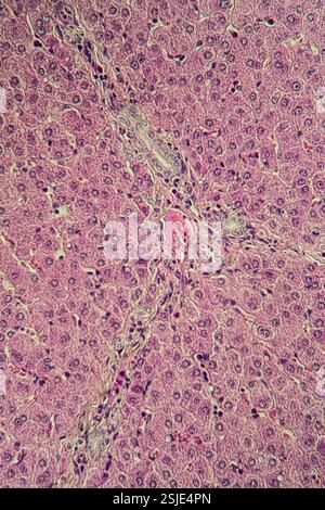 Pork liver section under the microscope 200x Stock Photo - Alamy