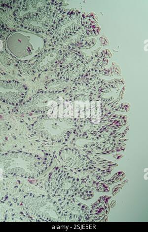 Tongue cross section with taste buds or gustatory cells. Optical ...