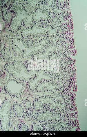 Tongue cross section with taste buds or gustatory cells. Optical ...