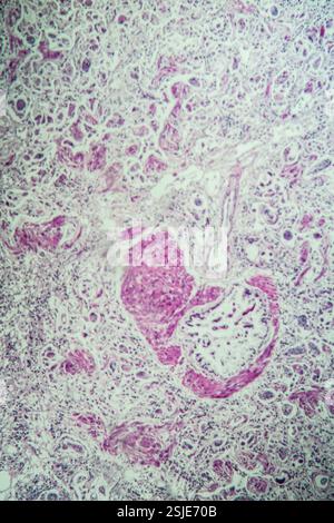 Lungworm in tissue under the microscope 100x Stock Photo - Alamy