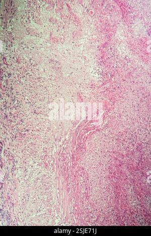 Gallbladder tissue under the microscope 100x Stock Photo - Alamy