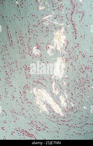 Kidney tissue under the microscope 200x Stock Photo - Alamy